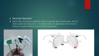 Telemetry Monitoring Lead Placement