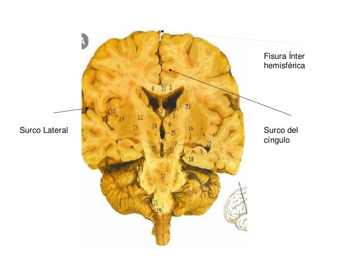 Anatomia Do Telencefalo