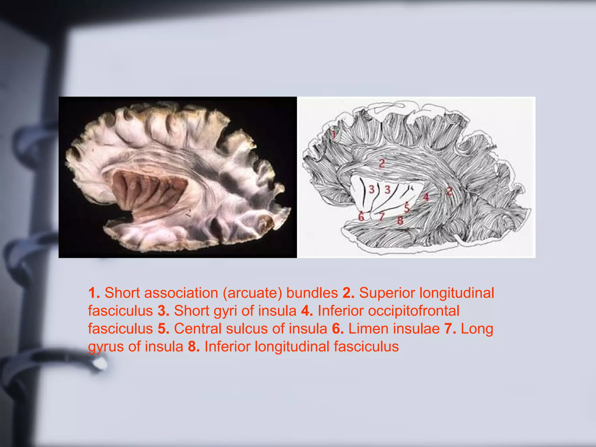 Anatomija Telencephalon | PPS | Brain and Nervous System Disorders ...