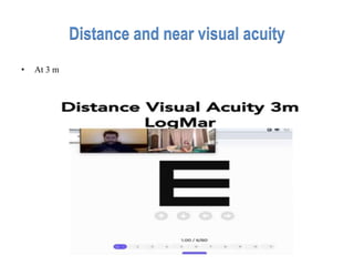Tele Optometry (kunj'sppt) / Basics of tele optometry. | PPTX