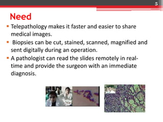 Telepathology | PPT