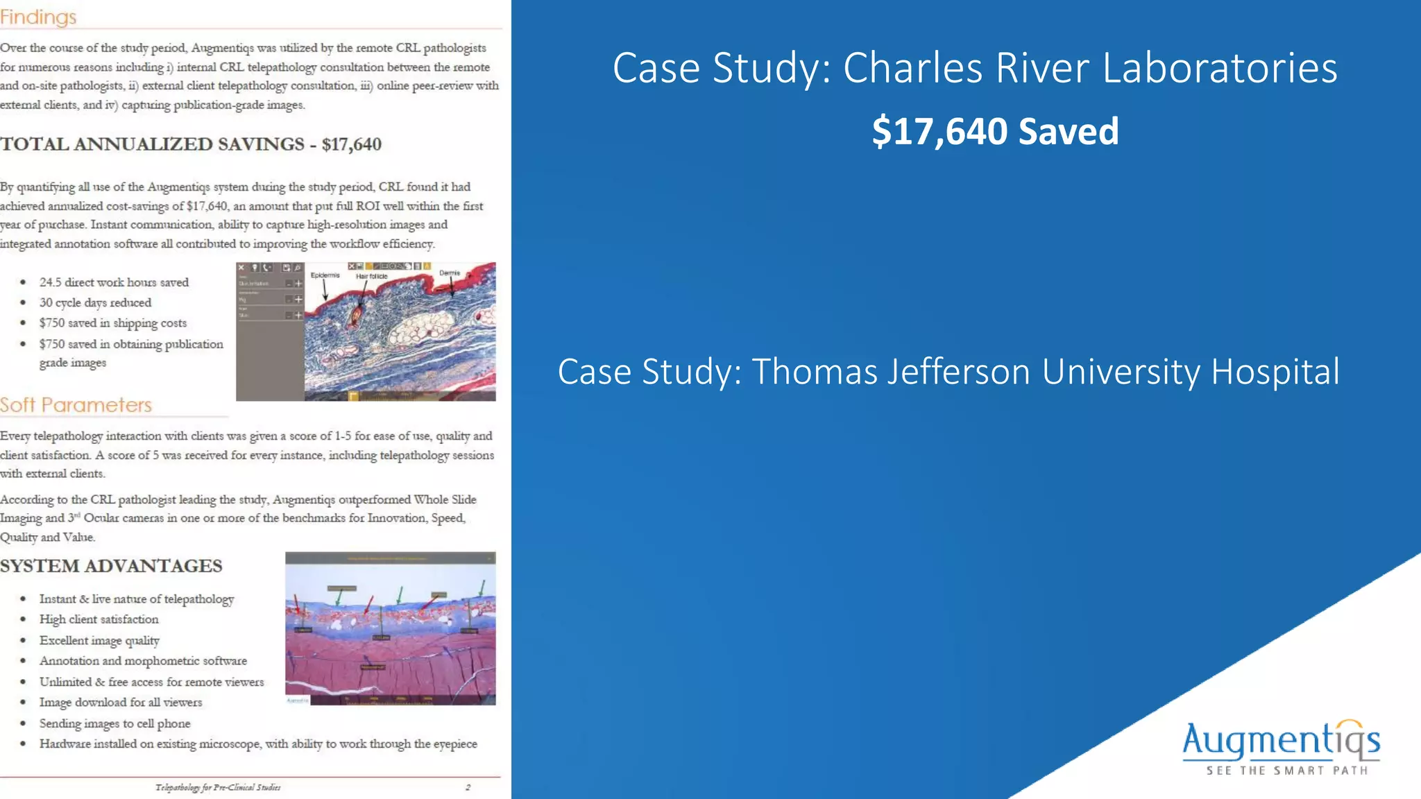 Telepathology - Digital Pathology in the Microscope | PPT