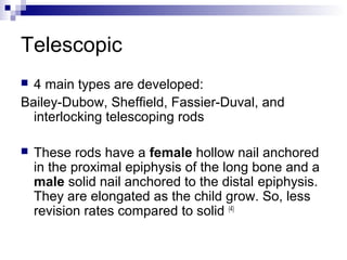 Telescopic nails in Osteogenesis Imperfecta | PPT