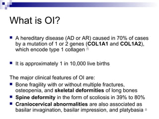 Telescopic nails in Osteogenesis Imperfecta | PPT