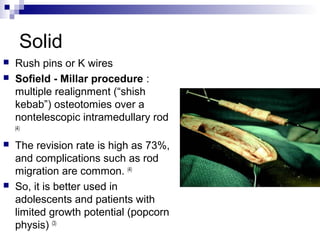 Telescopic nails in Osteogenesis Imperfecta | PPT