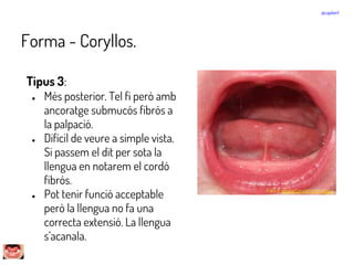 Tel lingual. diagnòstic i tractament 2014 | PDF