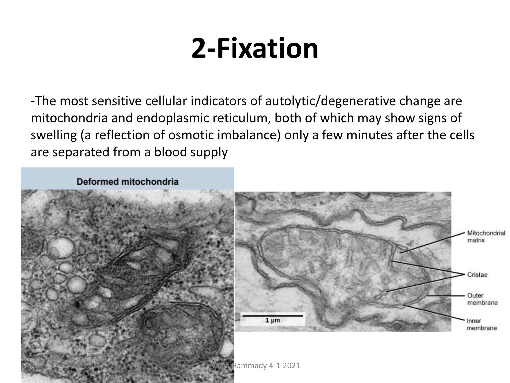 Transmission Electron Microscopy | PPT