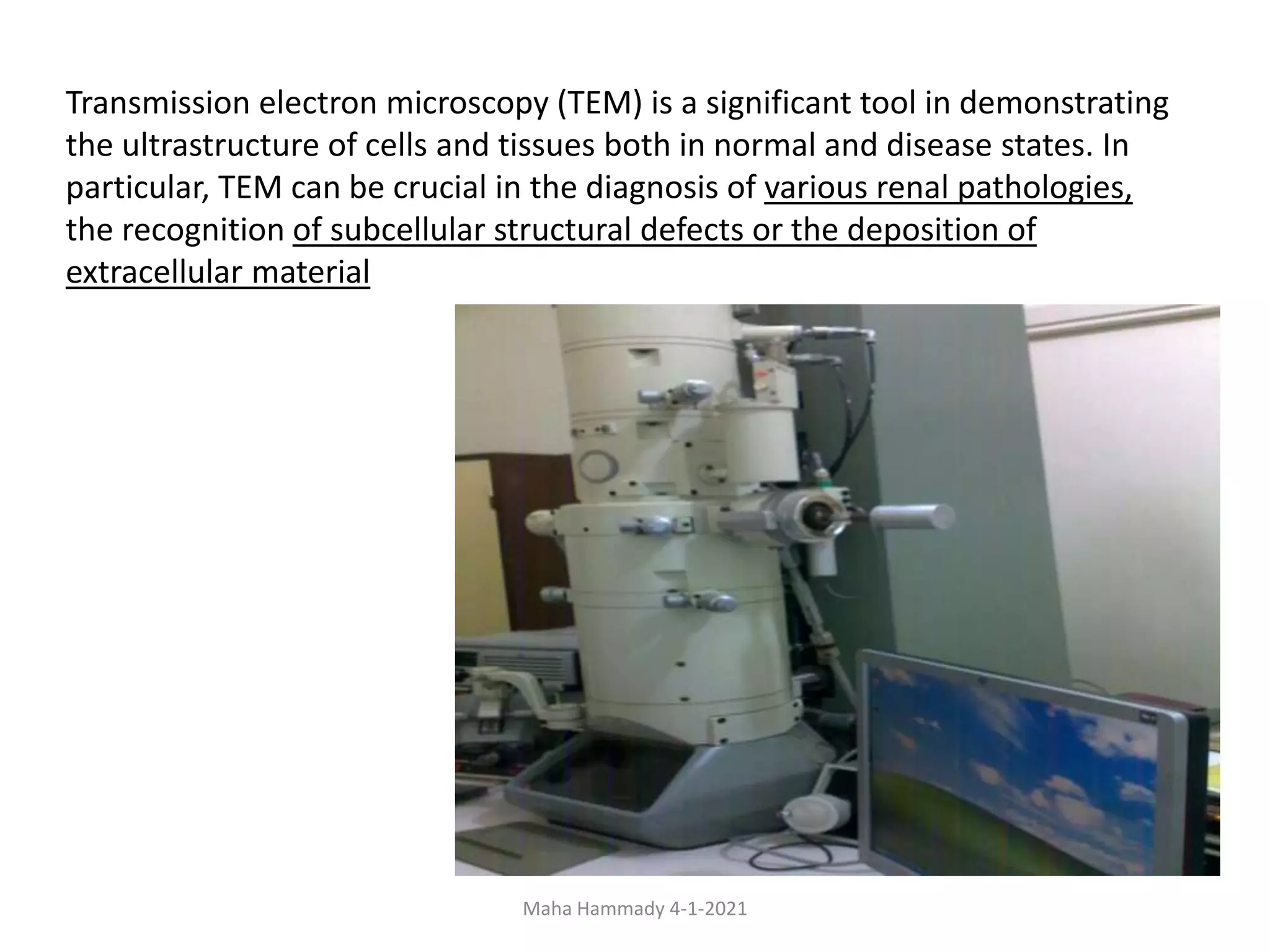 Transmission Electron Microscopy | PPT
