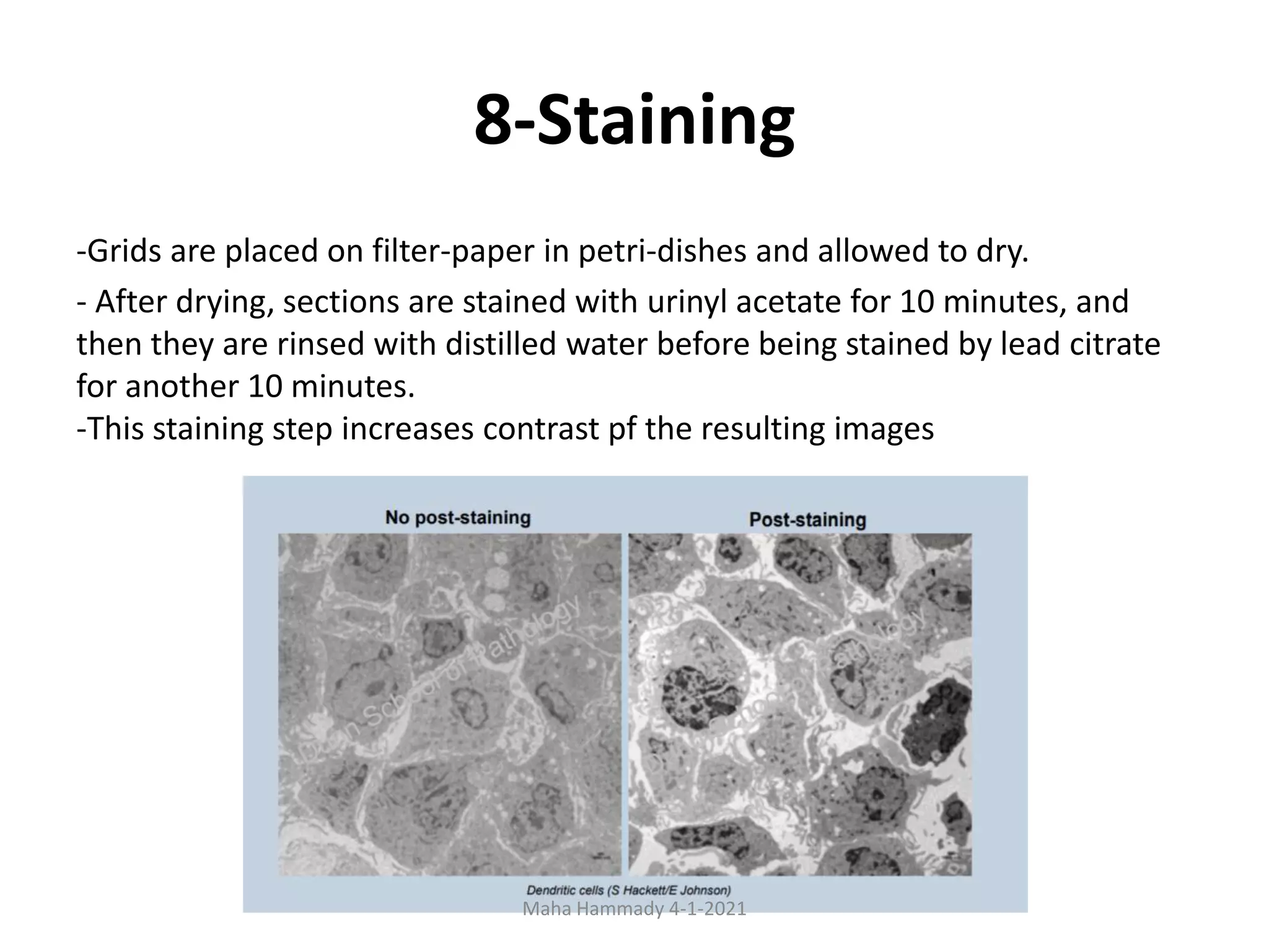 Transmission Electron Microscopy | PPT