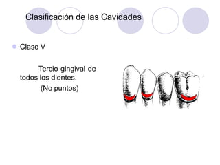 Nomenclaturas cavitarias | PPTX