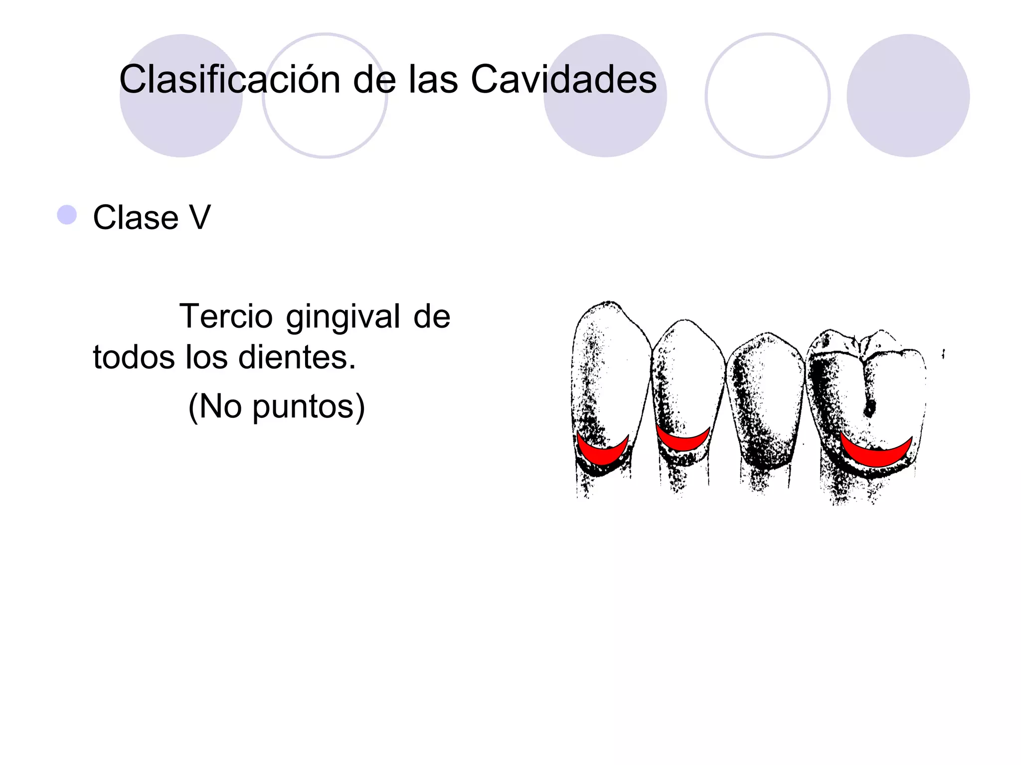 Tema 05 Nomenclatura Y Clasificacion De Las Cavidades | PPT