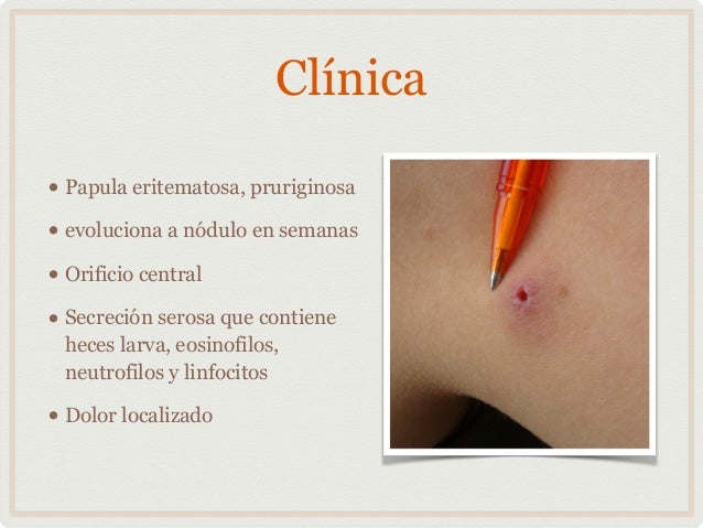 Miasis foruncular, Dermatobia Hominis
