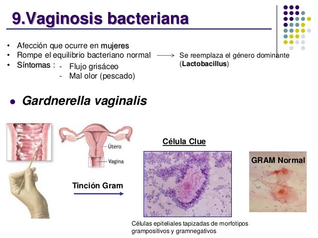 Tema 10. infecciones del tracto_genito-urinario