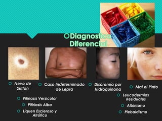 Discromias | PPTX