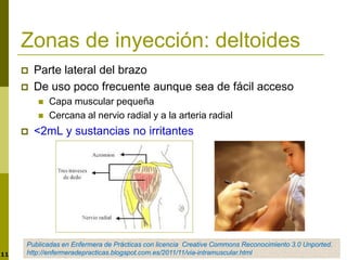 Tema_11_Via_intramuscular_OCW_REVISADO.pdf