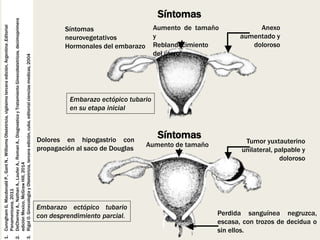 Embarazo ectopico | PPTX