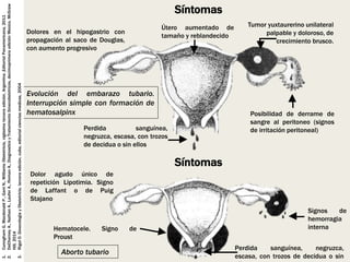 Embarazo ectopico | PPTX