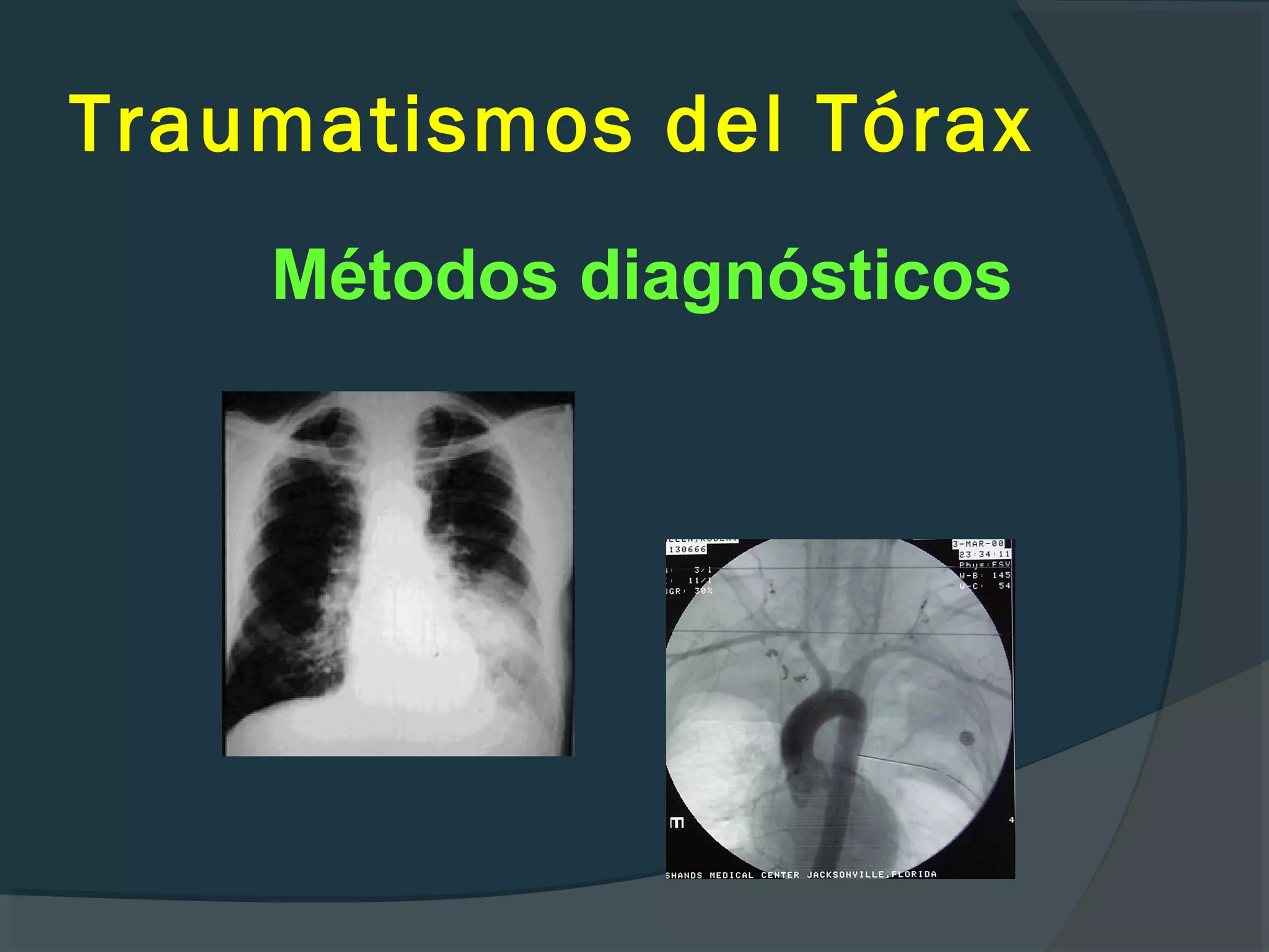 Tema 17 Trauma de Torax | PPT
