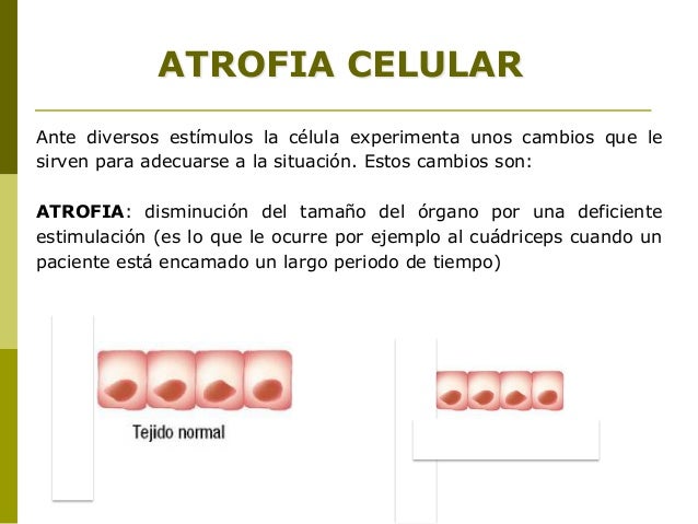 Tema 2. enfermeria . UFP. Canarias