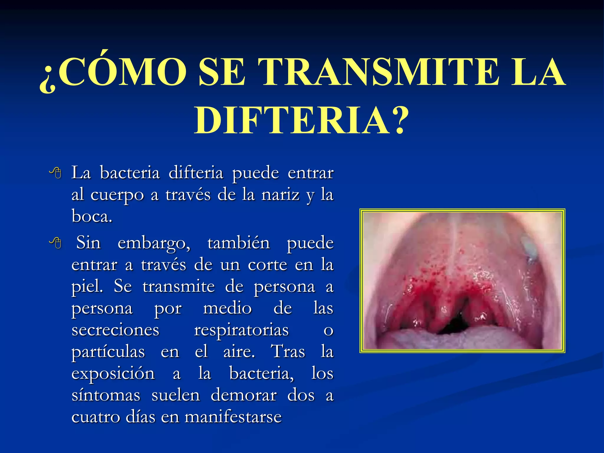 TEMA 21 DIFTERIA.pptx