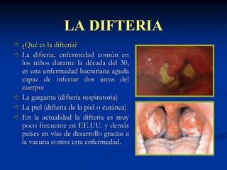 TEMA 21 DIFTERIA.pptx