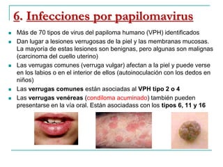 infecciones bacterianas y víricas de la mucosa oral | PDF