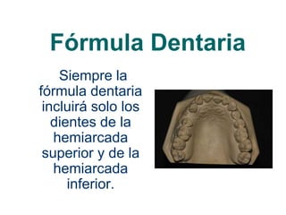 Formula Dental | PPTX