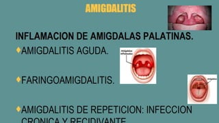OTORRINOLARINGOLOGIA Patología faríngea.pptx