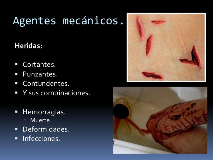 Tema 4. 1. enfermedades ambientales