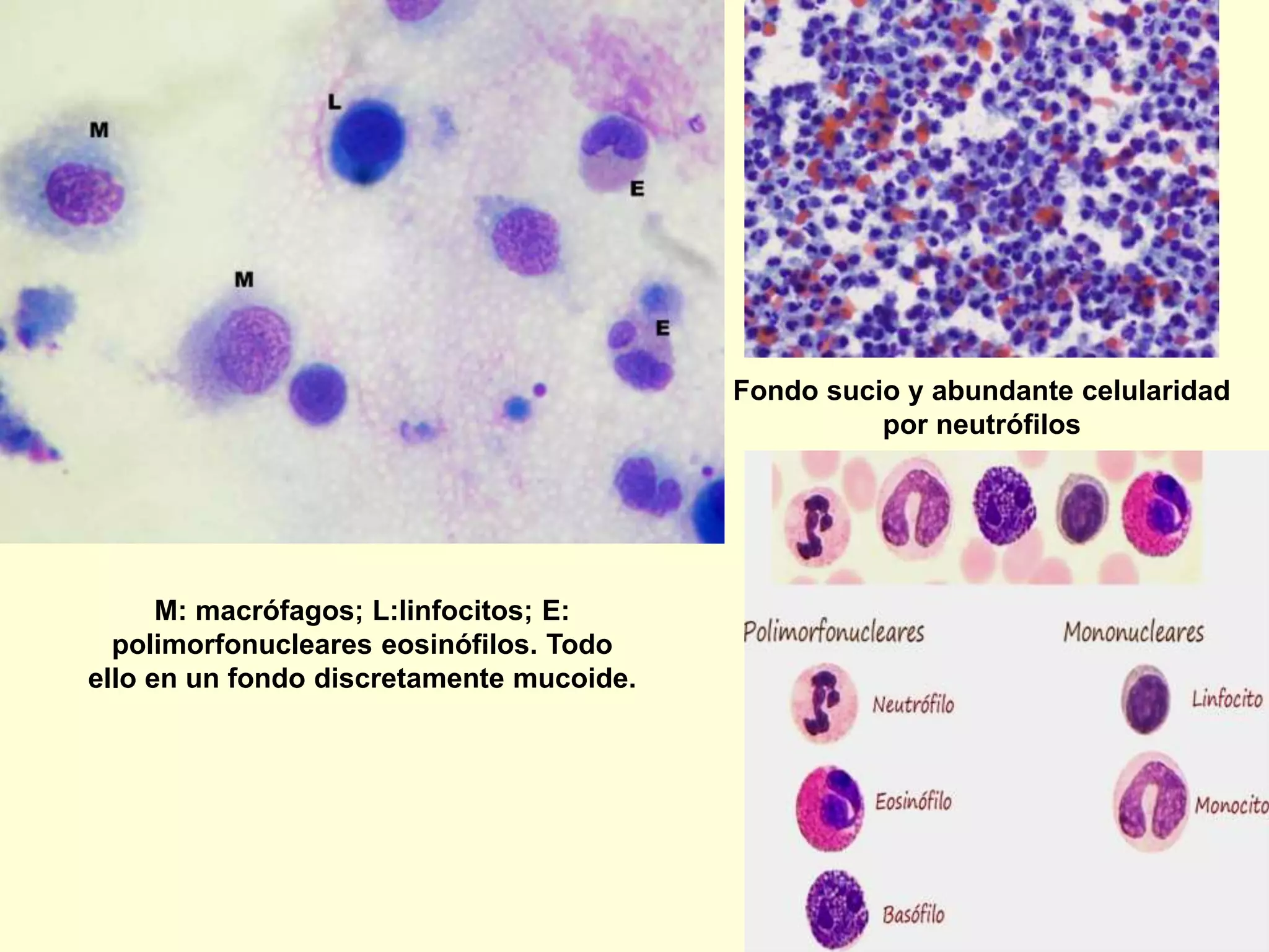 Tema 4. Citología ginecológica | PPTX