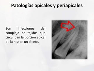 tema 4.1 PATOLOGÍAS-APICALES-Y-PERIAPICALES.pptx