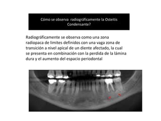 tema 4.1 PATOLOGÍAS-APICALES-Y-PERIAPICALES.pptx