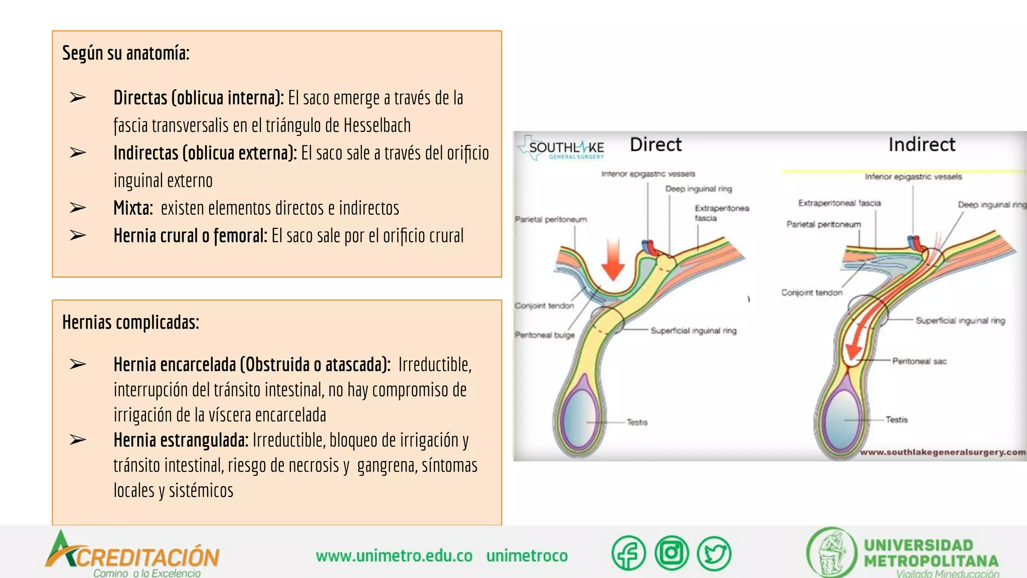 TEMA 4 - HERNIAS ABDOMINALES E INGUINALES.pdf