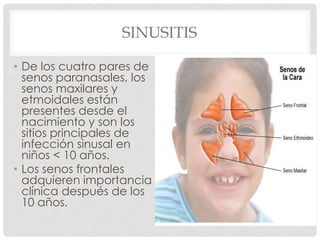 Sinusitis aguda | PPTX