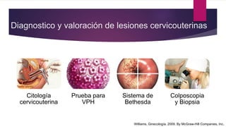 Patologia cervicales | PPTX