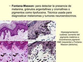 Tema 5. Procesamiento citológico y tisular | PPT