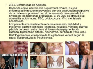 Tema 5. Aparato urinario y glándulas suprarrenales | PPTX