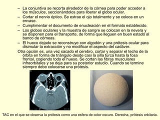 Tema 5. Necropsias | PPTX