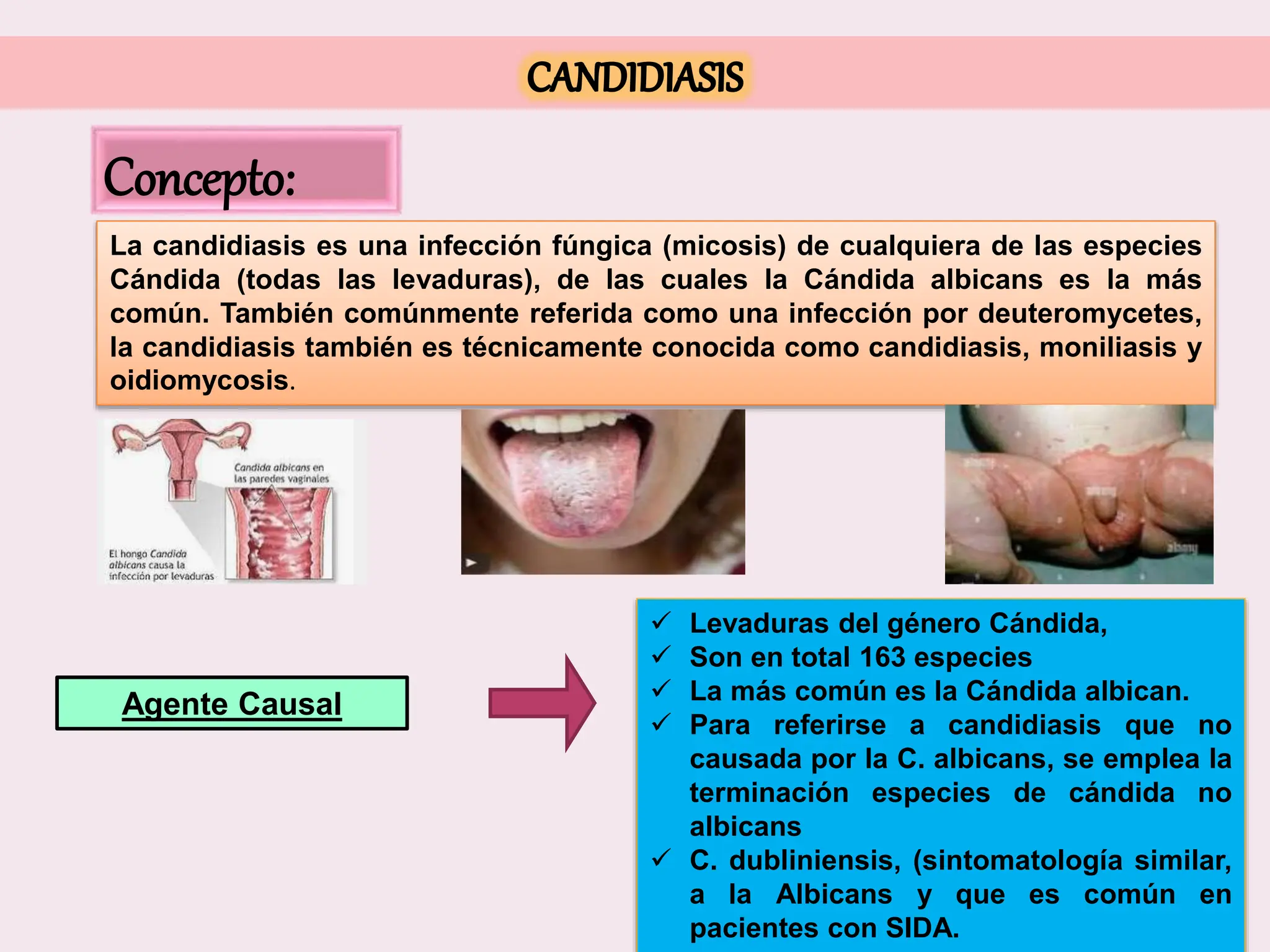 Diapositivas sobre la Candidiasis Tema 5.pptx | Infectious Diseases ...