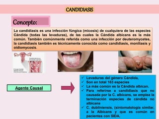 Diapositivas sobre la Candidiasis Tema 5.pptx
