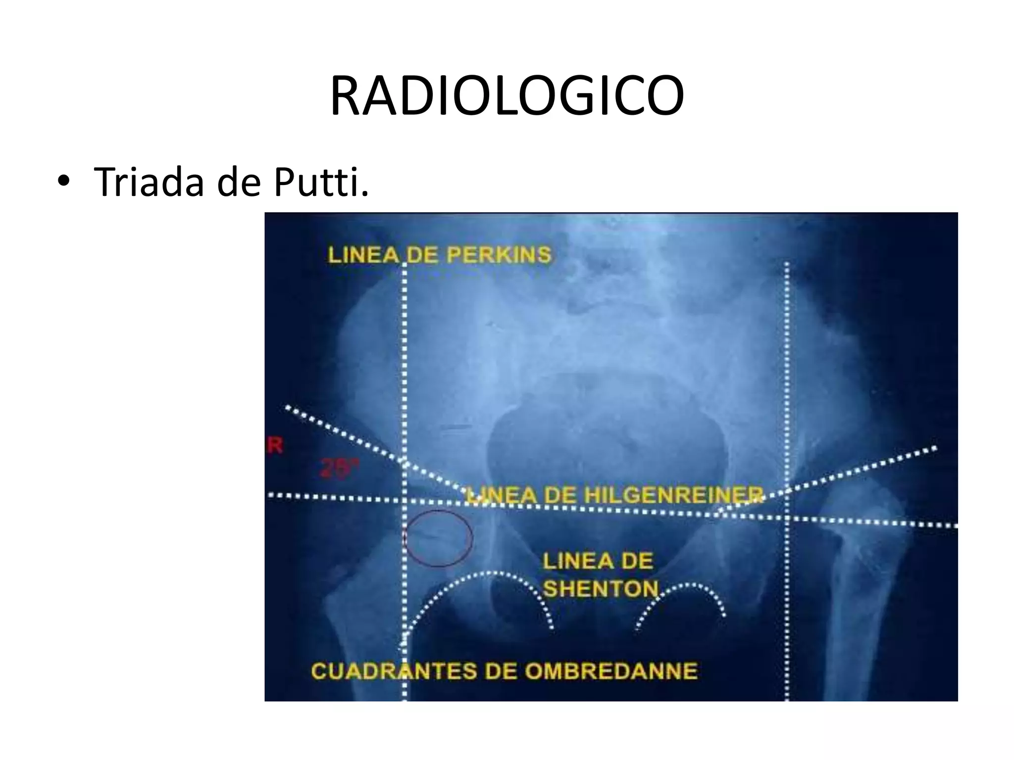 Tema 5 defectos posturales de cadera y miembros inferiores | PPT