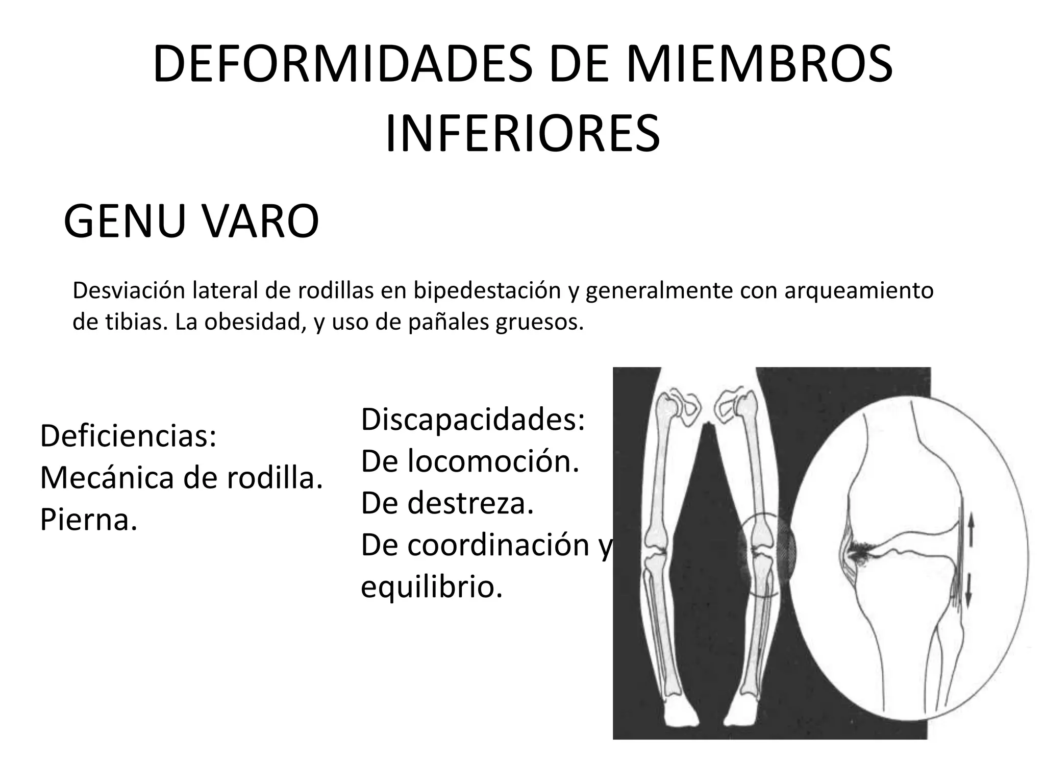 Tema 5 defectos posturales de cadera y miembros inferiores | PPT