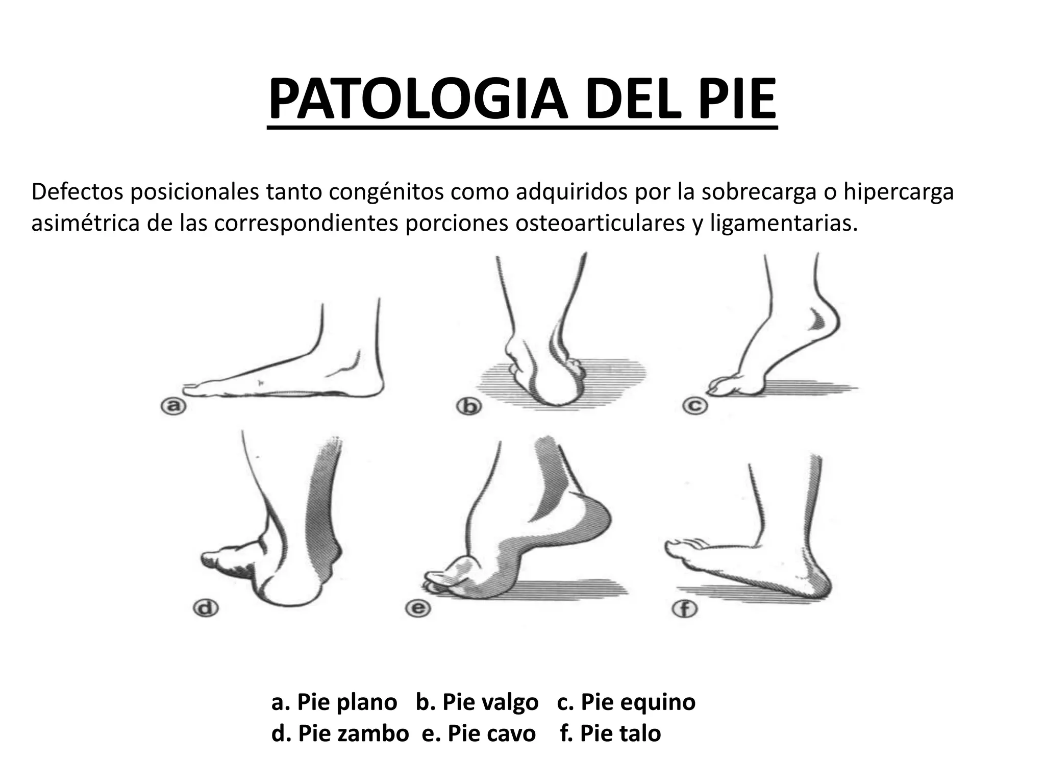 Tema 5 defectos posturales de cadera y miembros inferiores | PPT