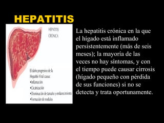 Tema 5 hepatitis | PPT