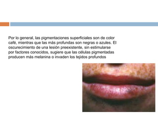 TEMA 5, PIGMENTACION DE LOS TEJIDOS BUCAL Y PERIBUCAL PATOLOGIA BUCAL.pptx