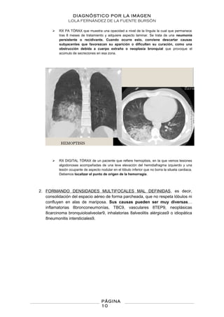 Diagnóstico por la imagen de la patología torácica. LolaFFB | DOC