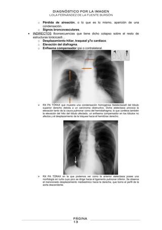 Diagnóstico por la imagen de la patología torácica. LolaFFB | DOC
