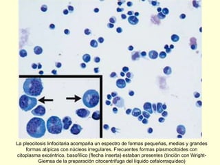 Tema 6. Líquidos orgánicos, sistema nervioso y globo ocular | PPTX