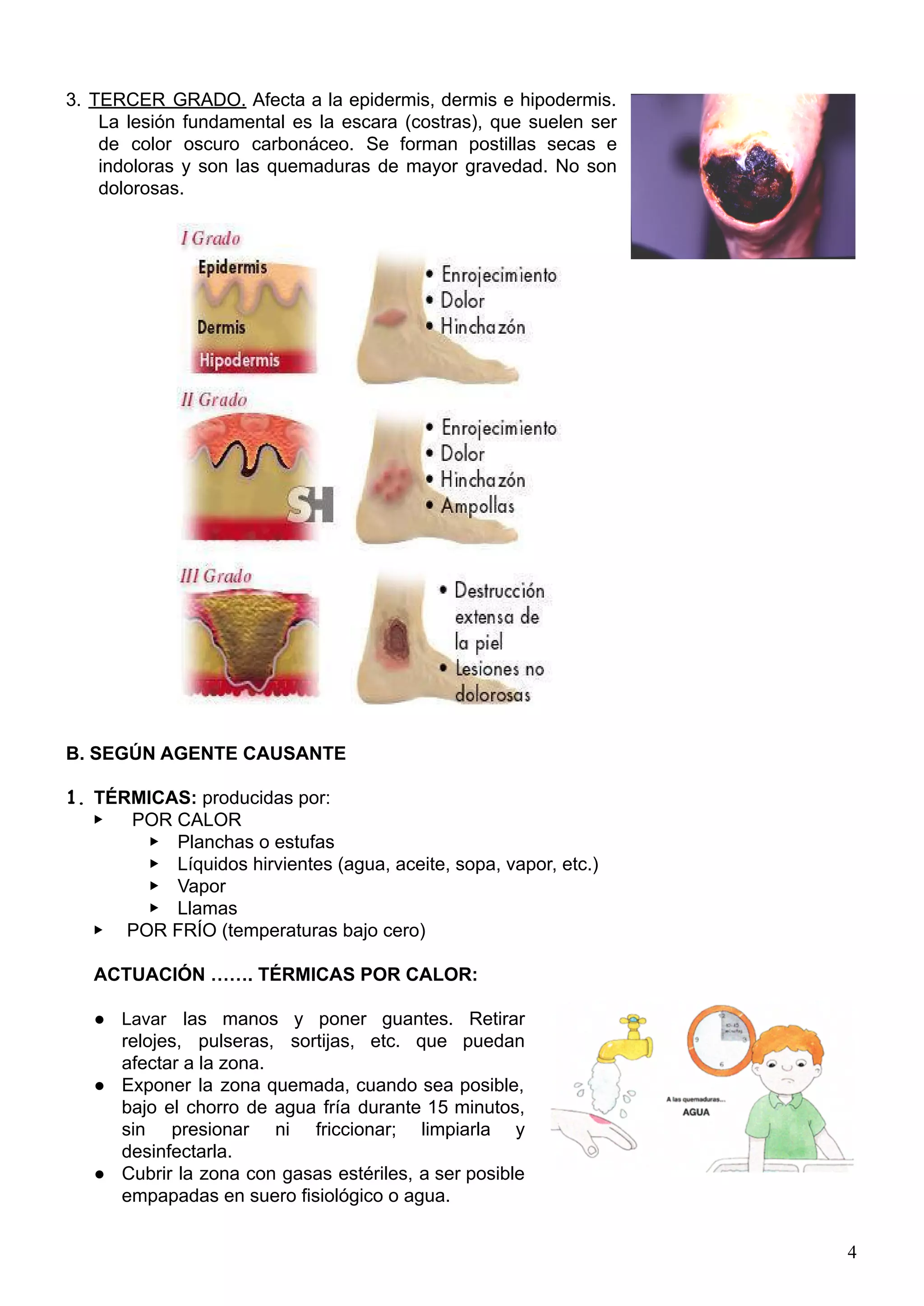 Tema_6_Quemaduras térmicas, químicas y eléctricas..pdf