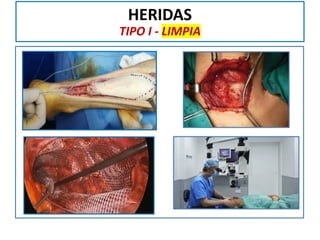 Comprehensive Overview of Wound Healing and Scar Formation Processes | PDF